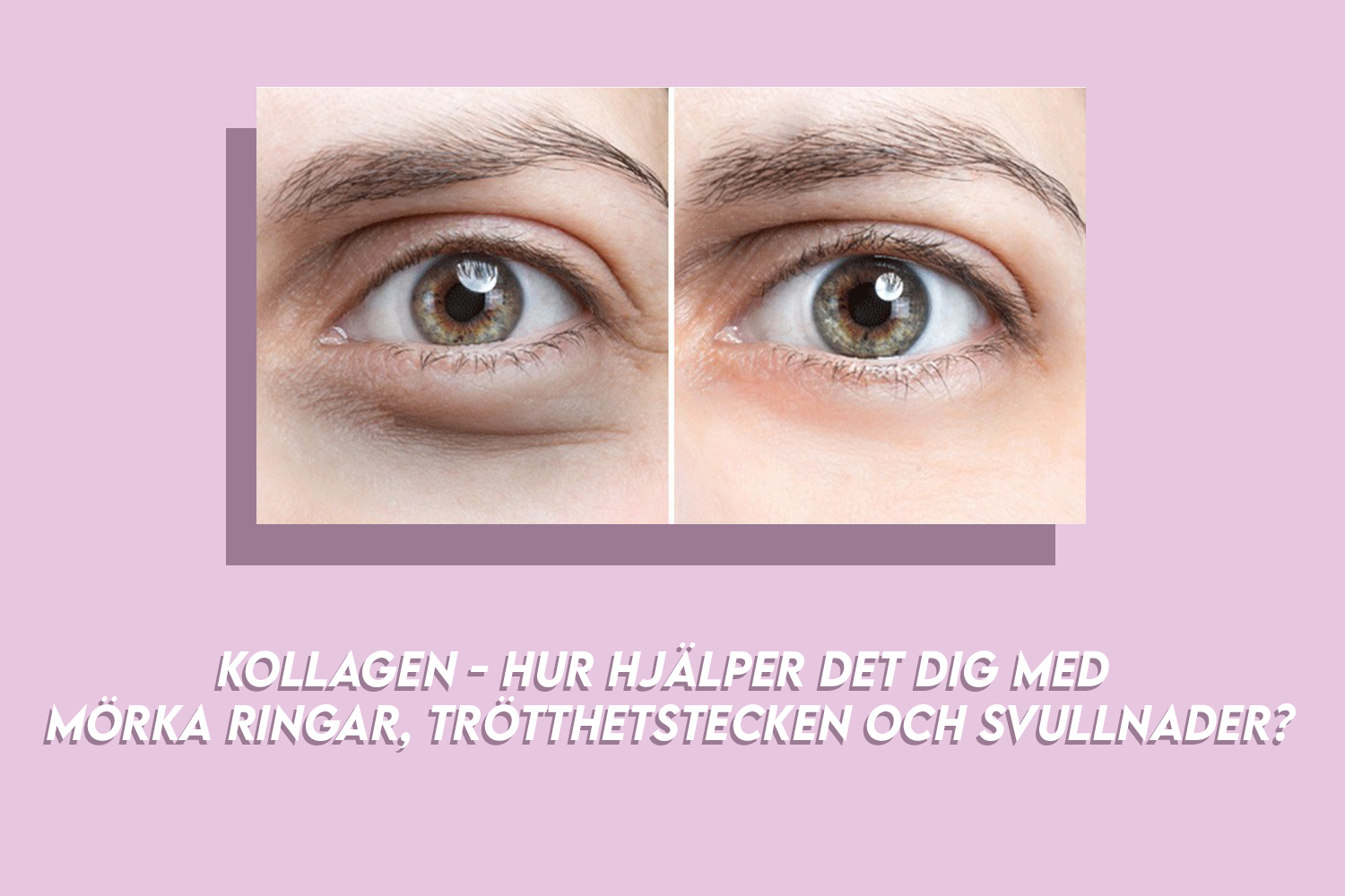 Kollagen - Hur hjälper det dig med mörka ringar, trötthetstecken och s ...